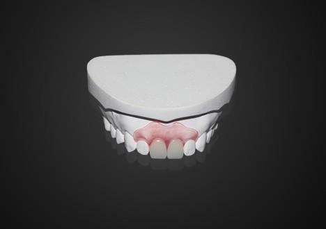  Valplast denture