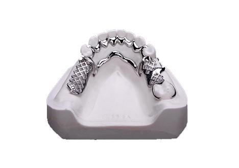 Vatallium denture