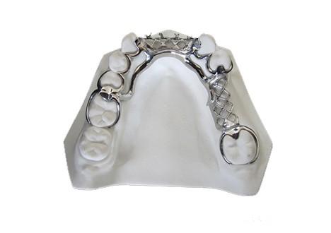 Vatallium denture