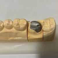 China Cocr Metal Post And Core Wear Resistant Customized For Efficient Restoration for sale