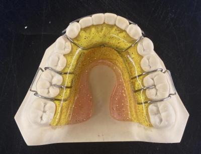 China High Accuracy Orthodontic Removable Appliance Safety Clear Hawley Retainer for sale