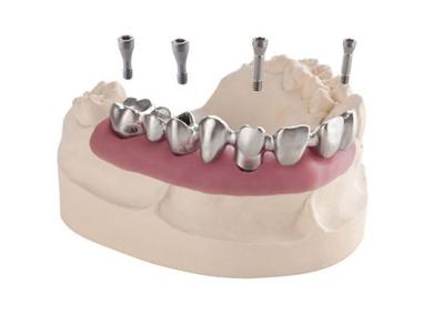 China Customized Replacing Dental Implant Crown Wear Resistant For Long Term Use for sale