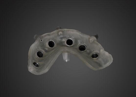 Digital implant surgical stent