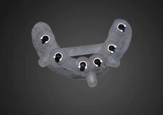 Digital implant surgical stent
