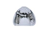China Anti Coloring Vitallium Partial Denture Customizable For Long Lasting for sale