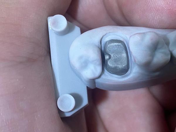 Corrosion Resistant Metal Post And Core High Adhesion For Dental Restoration