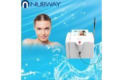 China Permanently Spider Veins Removal Machine / Portable Salon Beauty Equipment 30MHz for sale