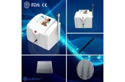 China 2016 new Fast effective laser spider vein removal machine with good quality for sale for sale