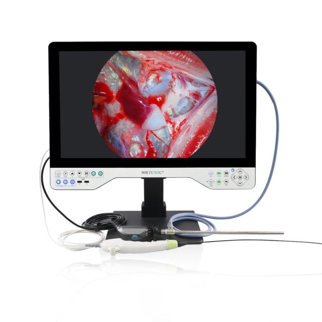 TUYOU TU-D1600T FHD CMOS Medical Endoscope Camera System for ENT Urological Surgeries 4