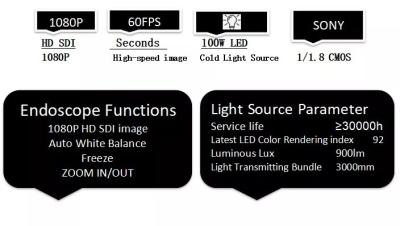 중국 1080P CMOS 휴대용 의료 엔도스코프 이미지 프로세서 판매용