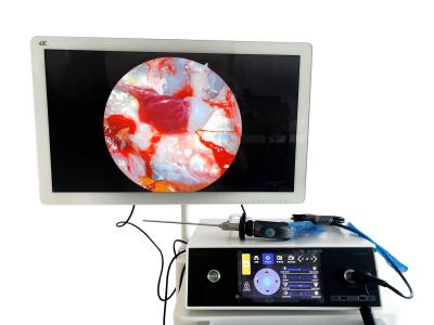 Cina TUYOU 1080P Sistema di telecamere endoscopiche ad alta risoluzione con schermo touch da 7" per ENT e ginecologia in vendita