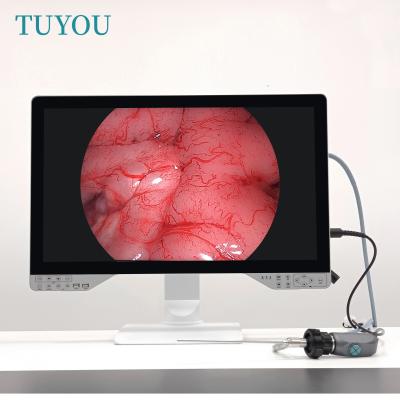TUYOU Telecamera per endoscopio medico All-in-One Full HD 1080P da 27 pollici per artroscopia