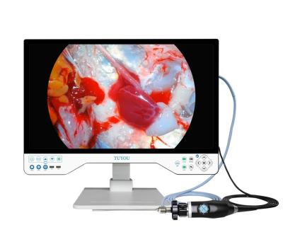 China HD Endoscopy Camera System with 80W Light Source and 3-Year Warranty for sale