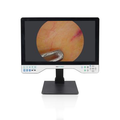 China 24" Endoscopic Endoscopy LED Light Source HD Endoscope Camera Recorder For Laparoscopy Cystoscope Surgeries for sale