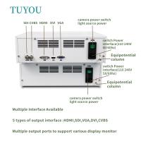 China Advanced 4-in-1 Endoscopic System Featuring Simultaneous Rigid and Flexible Imaging for sale