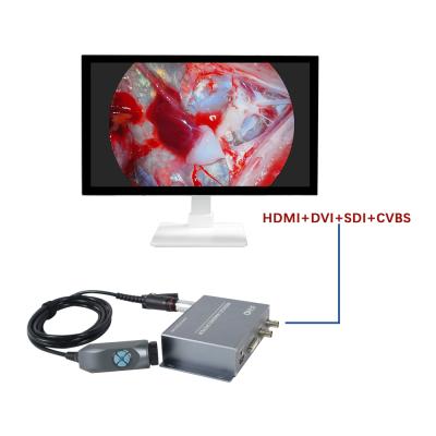 China Portable 1080P HDMI Rigid Endoscope Medical Camera For Animal Pet Veterinary for sale