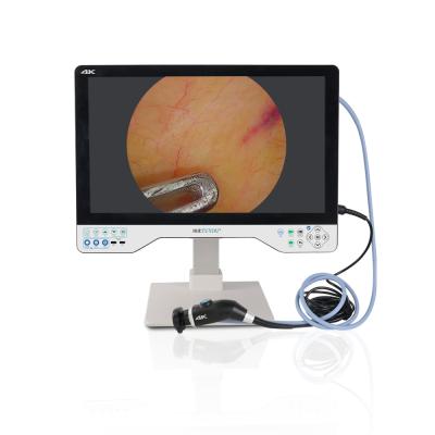China TUYOU 24 Inch 1080P Endoscope Camera with IPX8 Waterproof 8 Hours Battery Life and 2 Years Warranty for Medical Endoscopy for sale