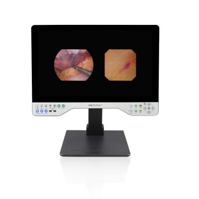 China OEM/ODM Factory Direct 24-Inch All-in-One Camera System with Rigid & Flexible Endoscope for ENT and Urological Surgery for sale