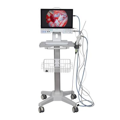 China 15'' All-in-One Full HD Endoscopy Camera System with Built-in LED Light Source for ENT and Urological Surgical Applications for sale