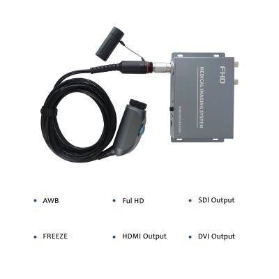 China Wireless Portable Endoscope Camera System - High Resolution for ENT/Orthopedics Clinical Examination for sale