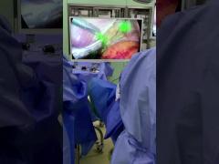 4K ICG 카메라 내시경 시스템과 레코더 라파로스코프 절차