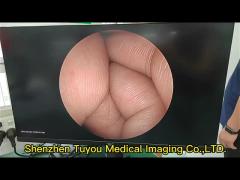1080P Full HD Medische Endoscopie Camera Video Recorder Met 6 inch Display Screen