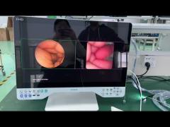 FHD tout en un système de caméra d'endoscope intégré LED Light & Flexible Scope pour la laparoscopie
