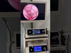 Nieuwe 4K Rigid Medical Touch Screen Endoscoop Camera System Gebruik in Histocope Urologie Chirurgie