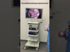 TU-D100A Ultra-High Definition 4K Endoscope Camera for Nasal, Ear, and Laparoscopic Surgery