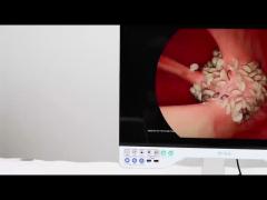 TUYOU UHD CMOS Sensor Tipo Endoscópio Médico Câmera Para Neurocirurgia Instrumentos de Uso
