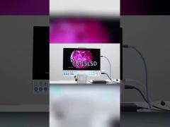 TUYOU Brain Surgery Tool All-in-One Rigid & Flexible Endoscopy Camera System voor baarmoederonderzoek