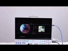 TUYOU 1080P 15,6 inch stijf alles in één endoscoopcamera systeem met videorecorder functie