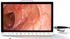 Portable 13.3 Inch 1080P Endoscopy Camera System With Recorder for Laparoscopy ENT Surgery