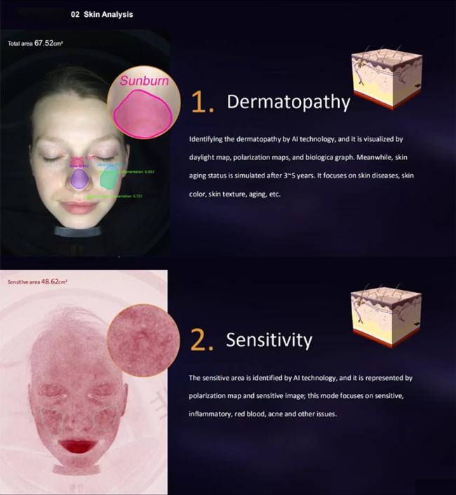 skin analyzer (3).jpg