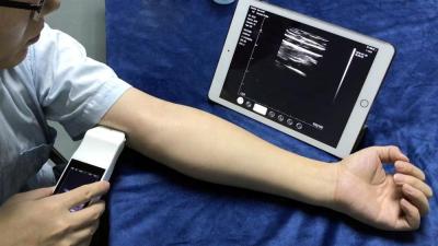 Cina Sonda lineare senza fili portatile di ultrasuono di doppler 7.5mhz in vendita