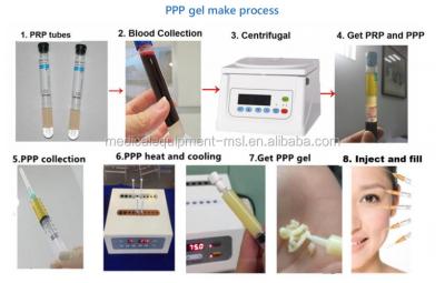 Cina Creatore autologo del gel del plasma del riempitore del collagene per tenere elasticità di pelle in vendita