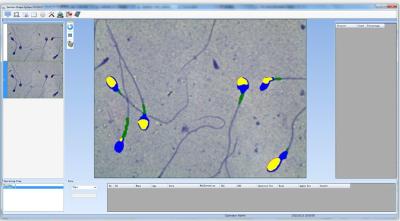 China Analisador controlado por computador semi automático do esperma do sistema de análise do esperma à venda
