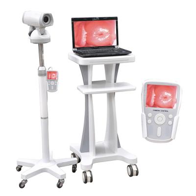 China Professionele Videocolposcope-Endoscoopgynaecologie Colposcope CE03 Te koop
