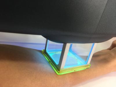 China Lamp Phototherapy Vitiligo Excimer Laser Treatment 308nm Targeted Cure for sale