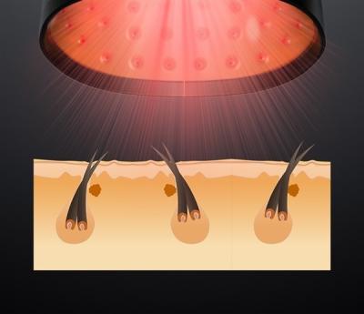 Cina Cappuccio di terapia laser di HairPro di trattamento di perdita di capelli del laser dei diodi dell'ABS 81 in vendita