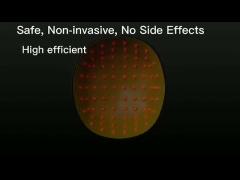 FDA CE 81 Diodes Hair Loss Laser Cap 650nm Wavelength Hair Growth Cap