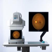China Digital OCT Fundus Camera Computer Aided For Eye Diseases for sale