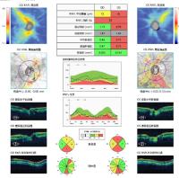 China OCT Optical Coherence Tomography Machine Posterior Segment for sale