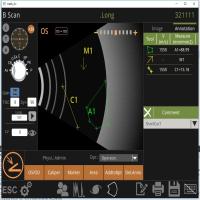 China Computerized Ultrasonic Scanner 10MHz Imaging Devices for sale