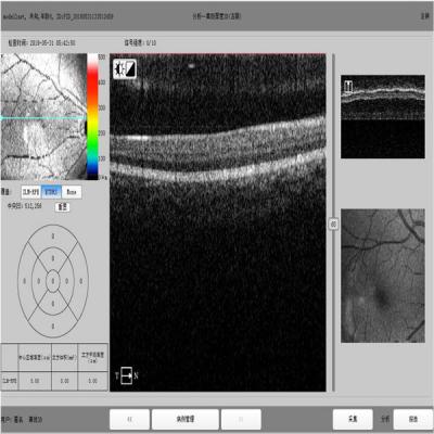 China 3D Optische het Materiaal Hoge Resolutie van de Coherentietomografie Te koop