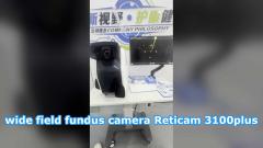 wide field fundus camera Reticam 3100plus