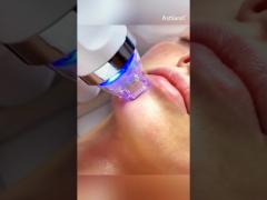 RF microneedling for skin rejuvenation #skincare #fyp #beautymachine #salonequipment #glowingskin