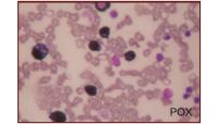 China Leukocyte Peroxidase (POX) Stain (Benzidine Method) for sale