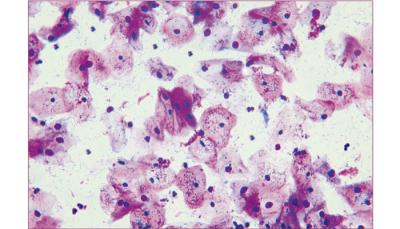 Cina Soluzione di macchie di cellule esfolianti 1x100 ml 2x100 ml Per diagnosi medica in vendita