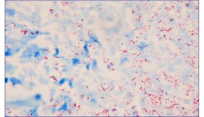 Cina TB Metodo di fluorescenza delle macchie 1BTx250ml per l' identificazione medica in vendita